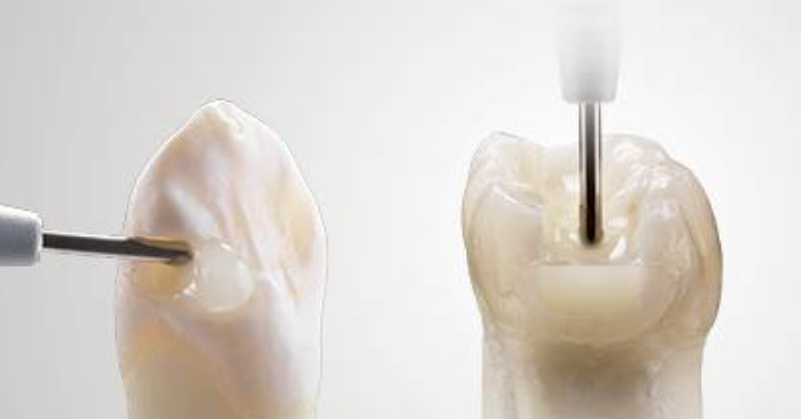 SDR flow+ | Al dente